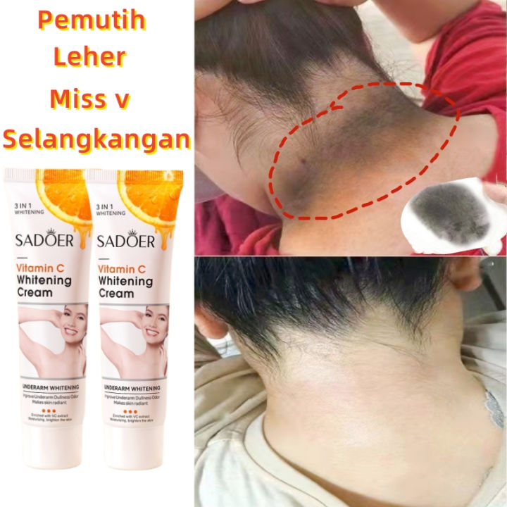 Underarm Whitening Bleaching Cream Private Parts Whitening Armpit Neck ...