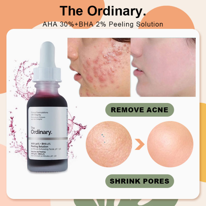 The Ordinary AHA 30%+BHA 2% Peeling Solution face serum mask Exfoliation,acne remover,acne marks ...