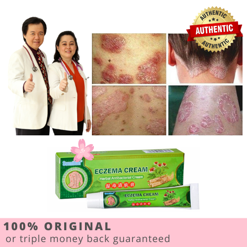 Sumifun Eczema Treatment Cream gamot sa kati kati sa balat buni ...