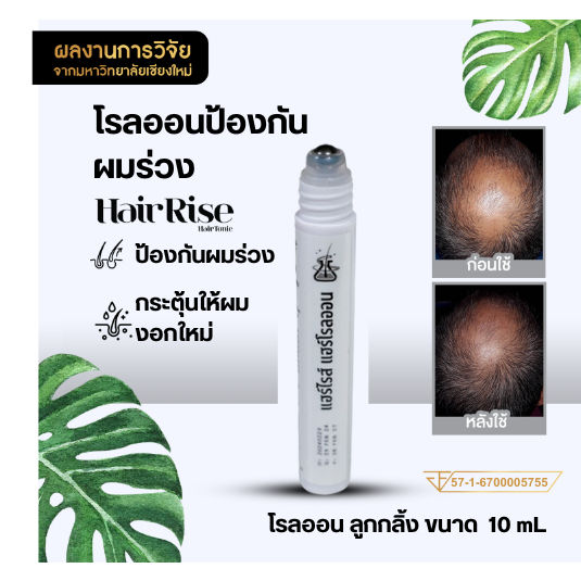 แฮร์ไรส์ แฮร์โรลออน Hair Rise Hair Roll-on ขนาด 10 มล. กระตุ้นผมงอก ลด ...