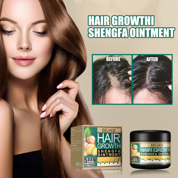 Eelhoe Ginger Hair Growth Care 30g Ointment Hair Fast Regrowth ...