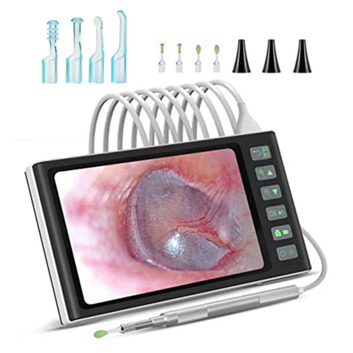 Digital Otoscope with 7-Inch Screen, Ear Camera, Visual Ear Scoop ...