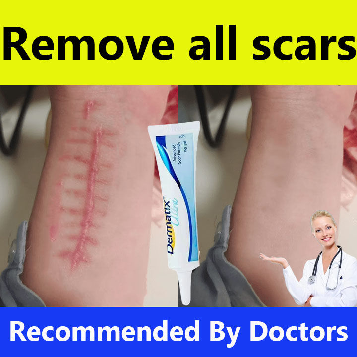 100% Effective face Scar Removal Cream Scar Cream Scar Gel Acne Scars ...