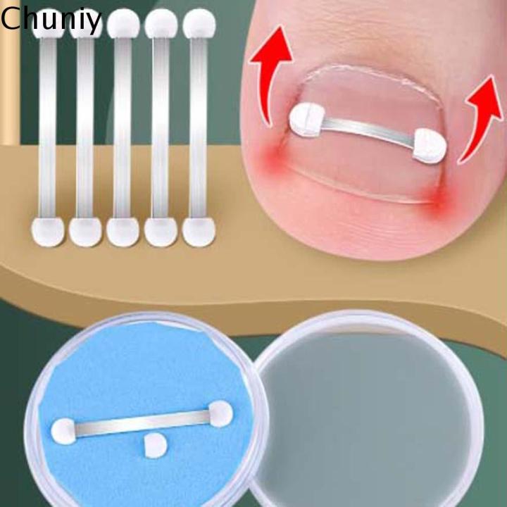 CHUNIY Adjustable Stainless Steel Toe Splint Support Pedicure Tool ...