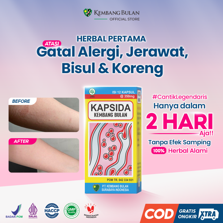 Kembang Bulan Kapsida 12 Kapsul - Obat Jerawat, Gatal-gatal, Bisul ...