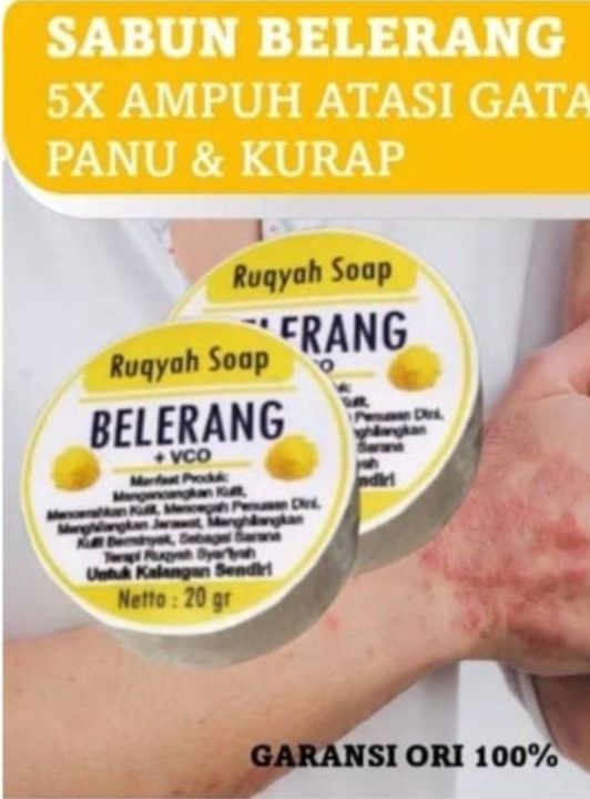 sabun gatal kulit paling ampuh / sabun belerang untuk gatal/ sabun muka ...