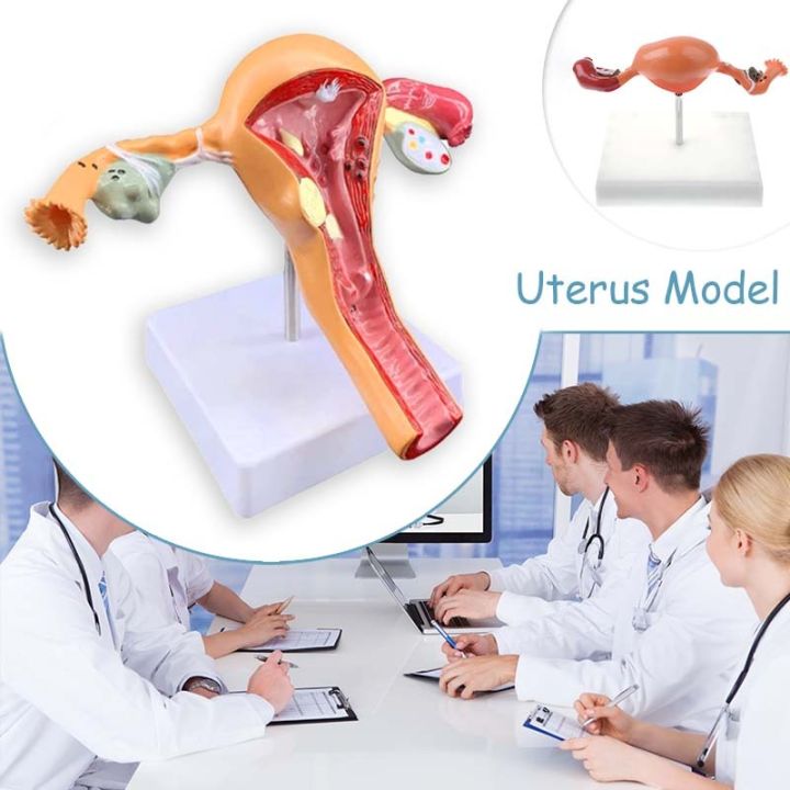 Alat Peraga Uterus Dan Ovarium Normal Dan Patologi Uterus Ovarium ...