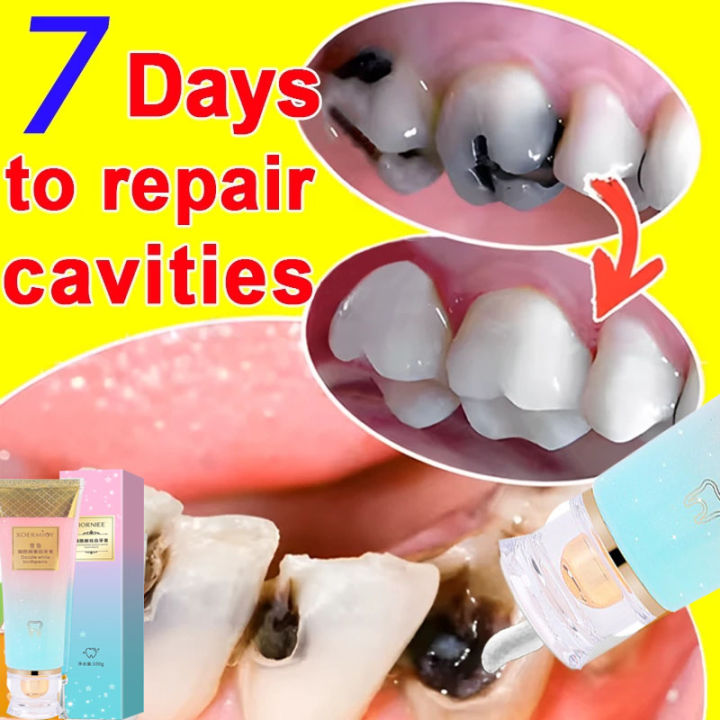 Anti-caries toothpaste, teeth repair toothpaste Tooth Decay Repair deep ...