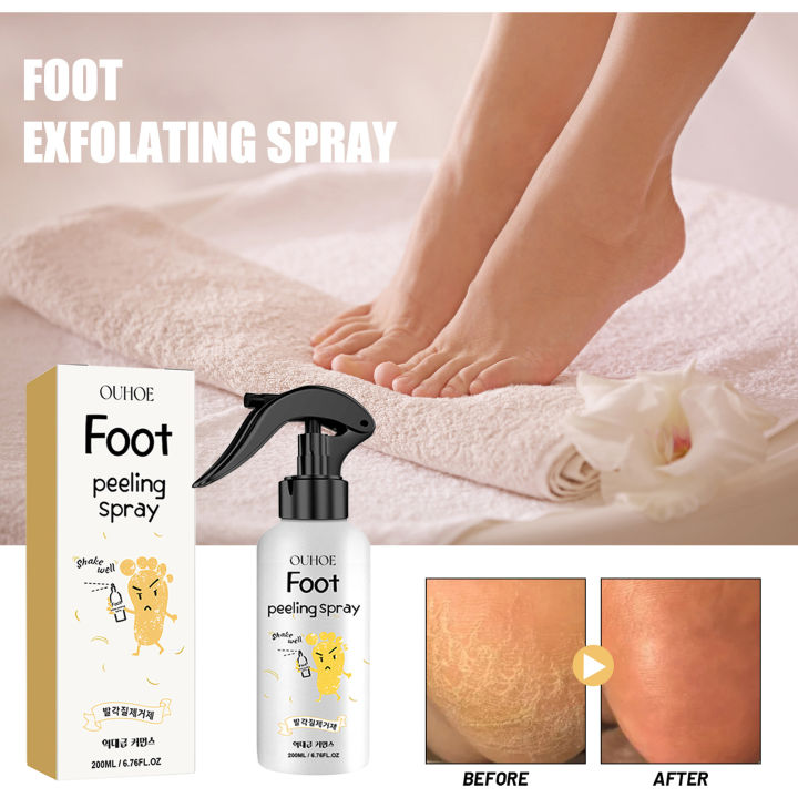Foot Peeling Spray, Moisturizing, Caring and Cleaning Dead Skin on The ...