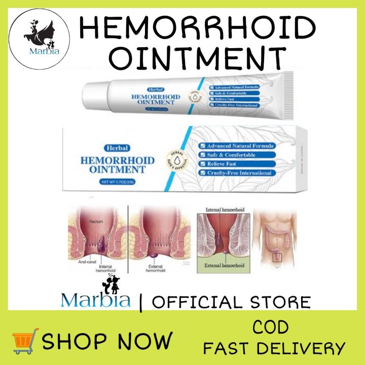 Authentic Hemorrhoid Ointment Internal Hemorrhoids External Hemorrhoids ...
