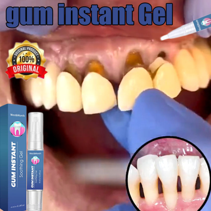 Gum Instant Soothing Gel Receding Gums Therapy Inflammation Treatment Tooth loosening Gingival ...