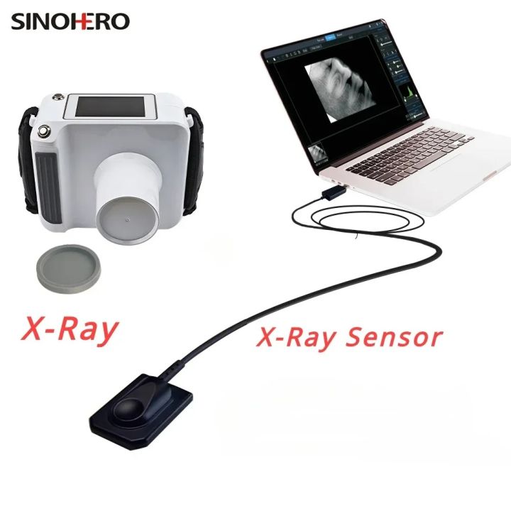 Sinohero Portable Dental X Ray Camera Frequency Imaging System X-Ray Machine Digital RVG Sensor ...