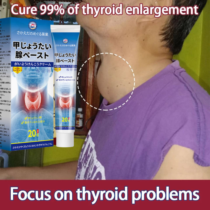 Thyroid cream, eliminates neck lumps, 20g, repairs hyperthyroidism ...