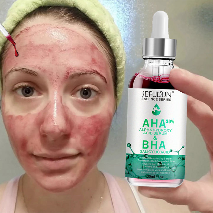 FaceAHA 30% + BHA 2% Acne Removing Serum Repair Hyaluronic Acid Face ...