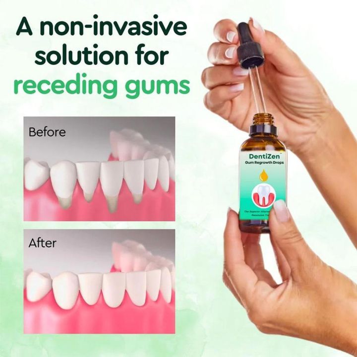 90ML Gum Regrowth Treatment Drops 30ml Dentizen Gum Regrowth Drops ...