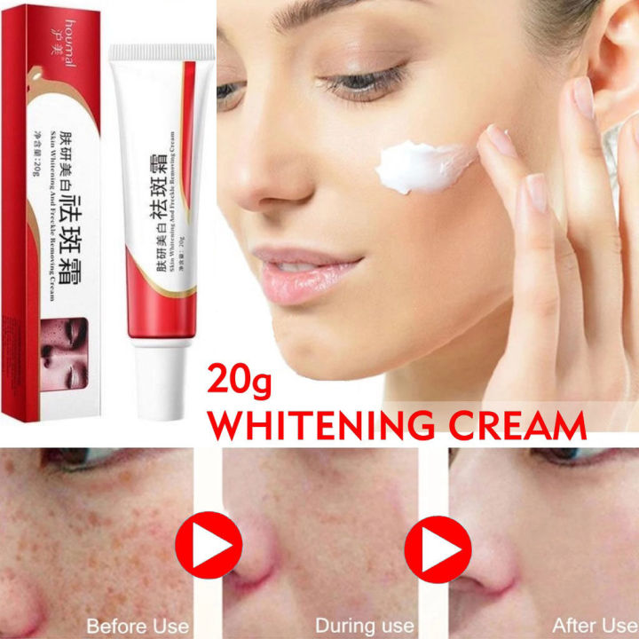 Effective freckle removal whitening cream melasma removal cream ...