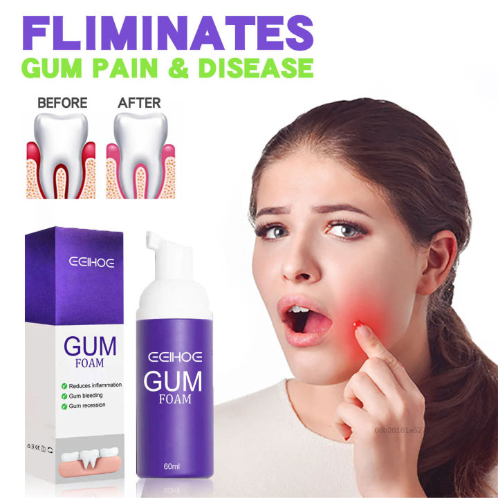 60ml Gum Pain Relief Toothpaste Reduce Inflammation Gum Bleeding Mousse ...