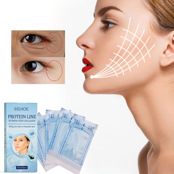 Protein Thread No Needle Gold 5 Bags/60Pcs Absorbable Anti-wrinkle Face ...