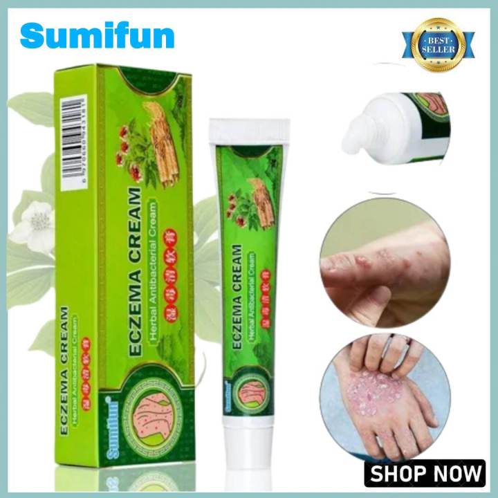 100% Effective! Sumifun Eczema Treatment Cream gamot sa kati kati sa ...