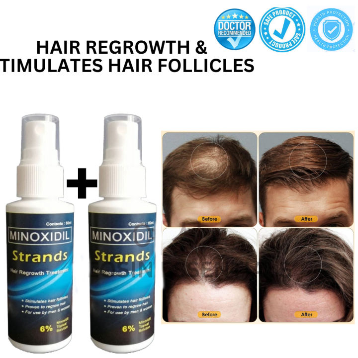 【BUY 1 TAKE 1】Minoxidil Strands 6% Minoxidil Hair Grower Original For ...