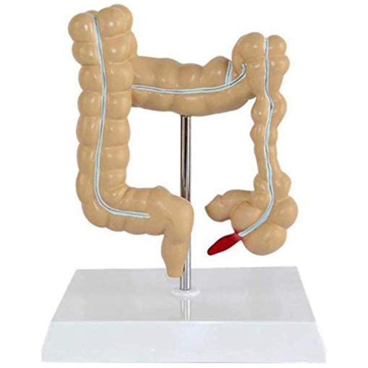 【Trusted】 Colon Pathological Colorectal Model Large Intestine Model ...