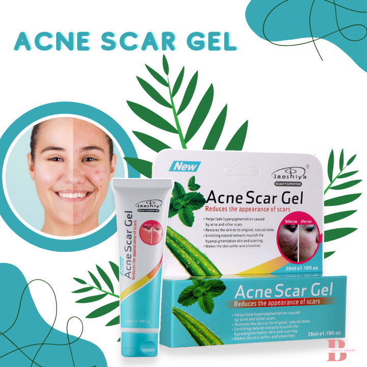 Acne Scar Gel Acne Scar Remover Pimple Mark Cream Dark Spot Remover ...