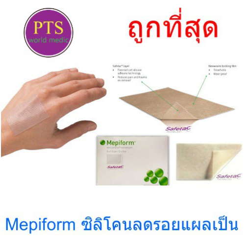 Mepiform Silicone Gel Sheet แผ่นซิลิโคนลดรอยแผล (1 แผ่น) | Lazada.co.th
