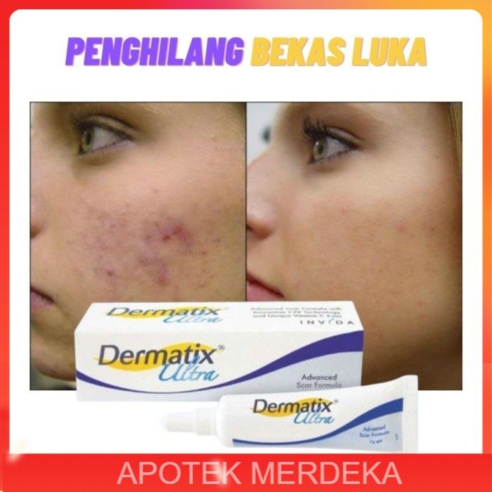 Dermatix Ultra Gel Salep Penghilang Luka 5Gr Advanced Scar Formula ...