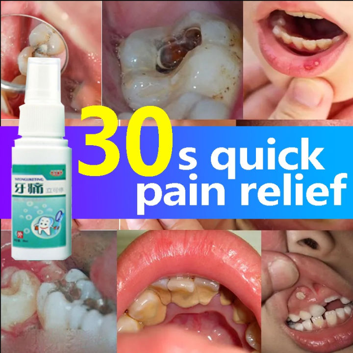 Gamot Sa Masakit Na Ngipin | Toothache Pain Relief 35ml | Bad Breath ...