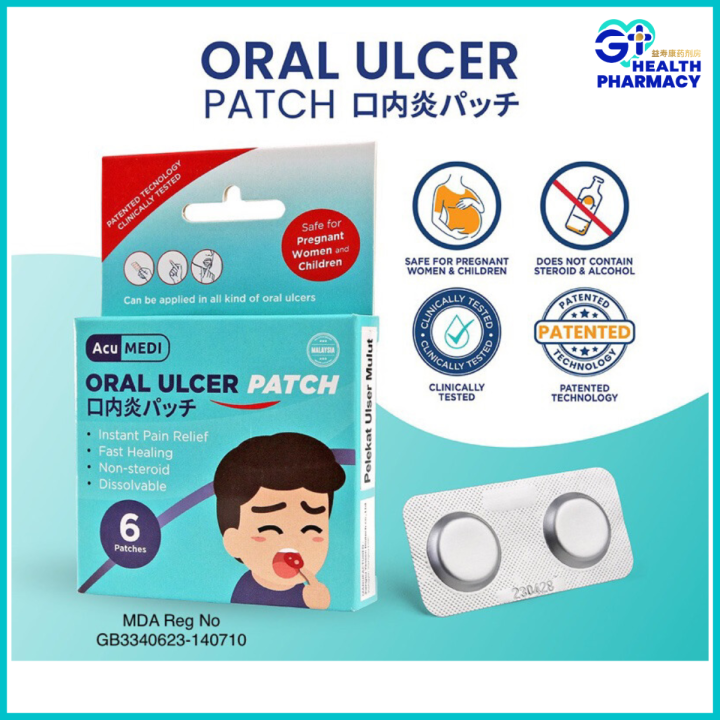 AcuMEDI Oral Ulcer Patch for Ulcer Treatment Mouth Ulcer Patch Pelekat ...