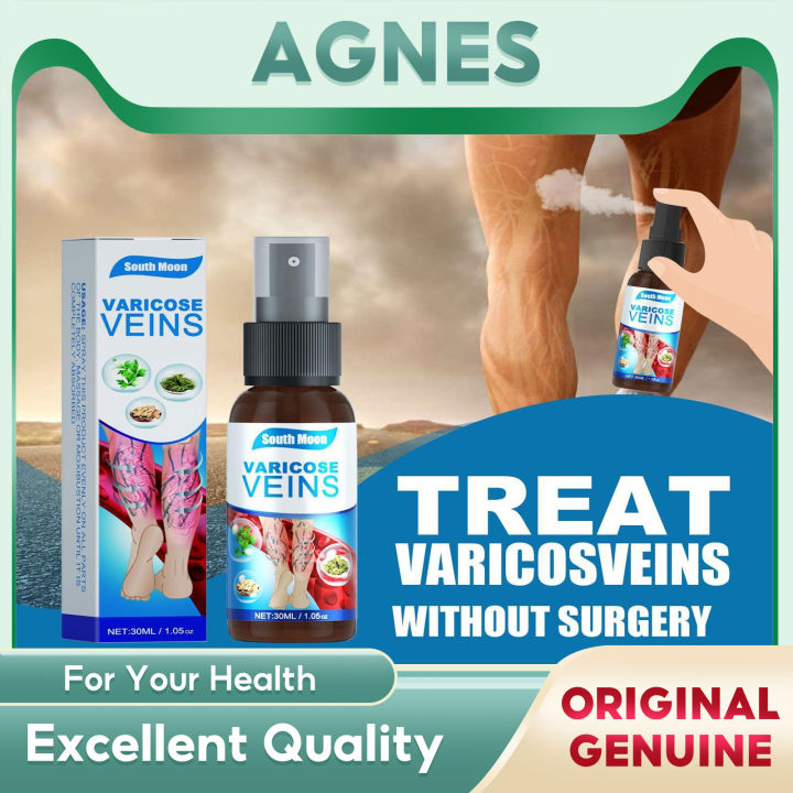 South Moon Varicose Veins Spray Blood Vessels Bulge Relief Phlebitis ...