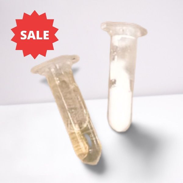 X3UZmN9k Glass ionomer repack (kasing tibay ng fuji) | Lazada PH