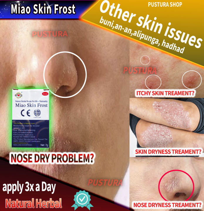 Cream MSF for dry skin An-an Buni Hadhad 7g | Lazada PH