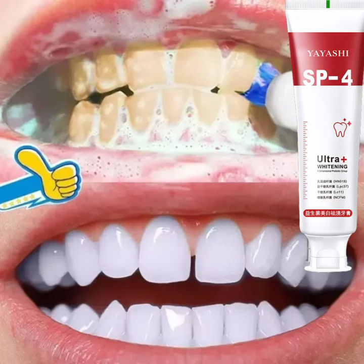 sip 4 Probiotic Toothpaste 120g pemutih gigi whitening teeth Remove ...
