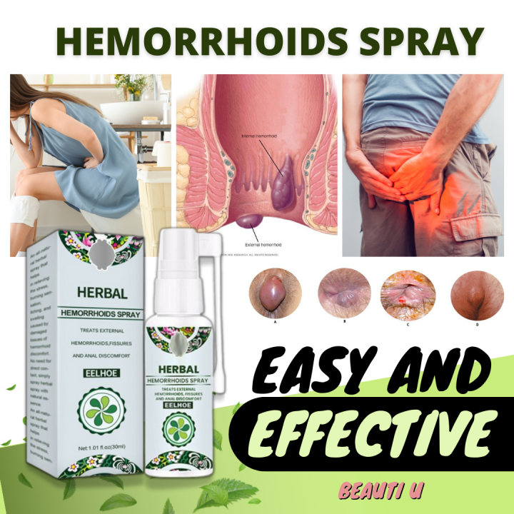 【Large quantity discount】MIRACLE Hemorrhoids ALMURANAS HERBAL SPRAY 30ml Hemorrhoids Cream ...