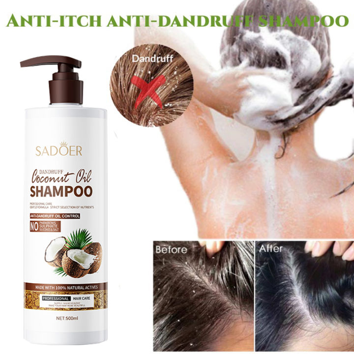 HISOO.BUY 1 TAKE 1 SADOER Coconut Shampoo Anti-Dandruff Repair Damage Hair AZLA Refreshing Oil ...