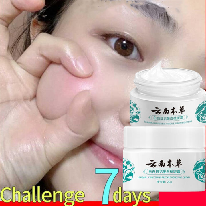 Japanese Melasma Cream Yunnan Herbal Whitening Freckle Cream Japanese ...