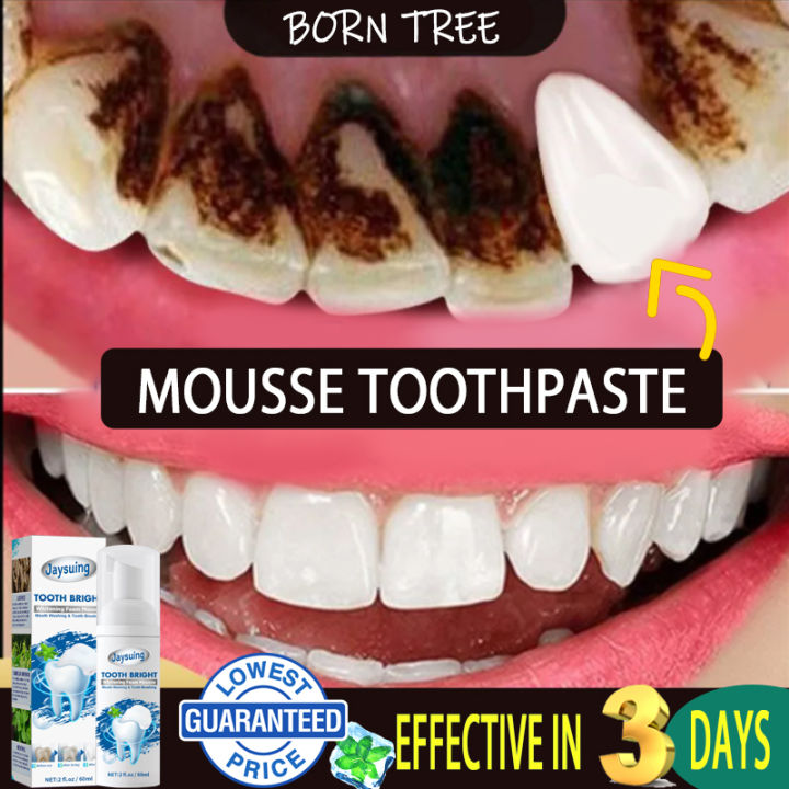 hunmui toothpaste original niacinamide toothpaste whitening for teeth ...