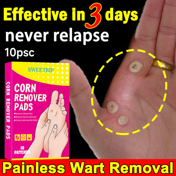 SWEETRIP 10 Pcs Feet Corns/ Warts Removal Patch 100% Effective Pain ...