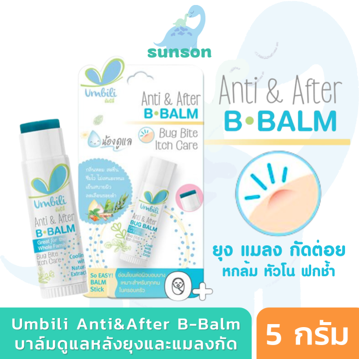 Umbili บาล์มทาหลังยุงกัด แมลงสัตว์กัดต่อย ฟกช้ำ หัวโน รอยขีดข่วน สำหรับ ...