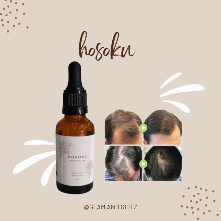 Minoxidil 15% Hosoku Hair Growth(with collagen and castor oil) Hair ...