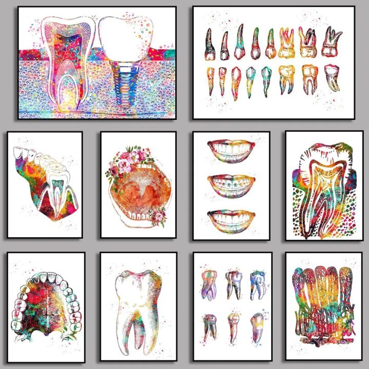 Tooth Implant Dentist Anatomy Artwork Canvas Wall Painting Dental ...