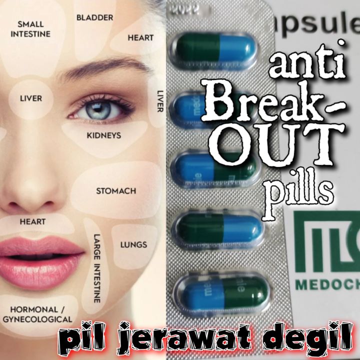 Anti BreakOut Pills Pimples Gel Pimples Topical Treatment of Acne ...
