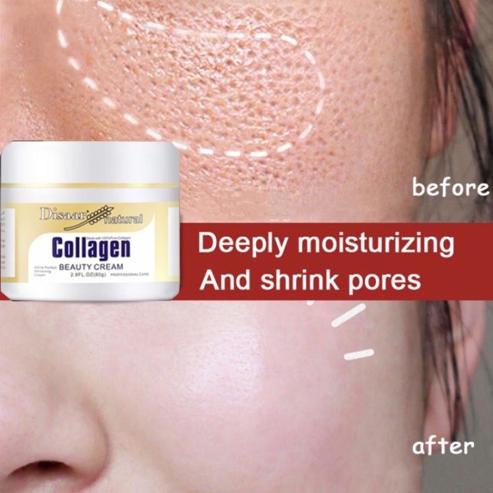 DISAAR Collagen Cream 80g Face Cream Lighten Dark Spots Repair Damaged ...