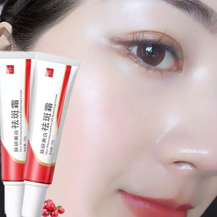 【3DAYS Whitening 】melasma and pekas remover Freckle Cream for Freckles ...