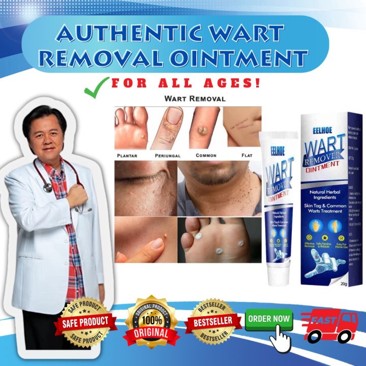 warts remover original watson warts removal kasoy oil warts remover ...