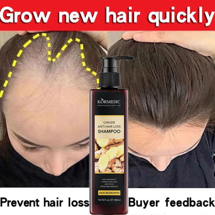 Ginger Shampoo Original Anti Hair Loss Nourish Hair Fast Growth Shampoo Oil Control Anti ...