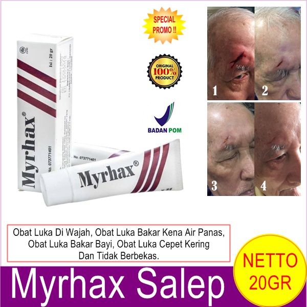 PROMO salep myrhax 20g salep luka bakar melepuh salep luka koreng ...