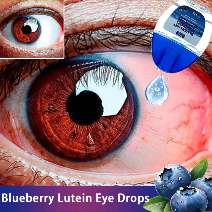 Cataract eye drops Blueberry lutein eye drops 13ml are used for ...