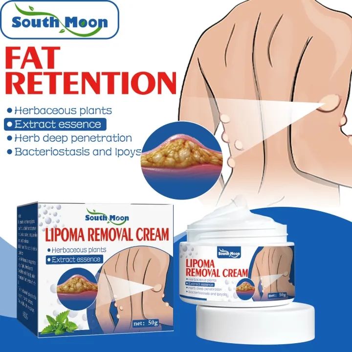 [HCM]50g Kem mềm u mỡ Lipoma Cream Subcutaneous Lump Removing Cream ...